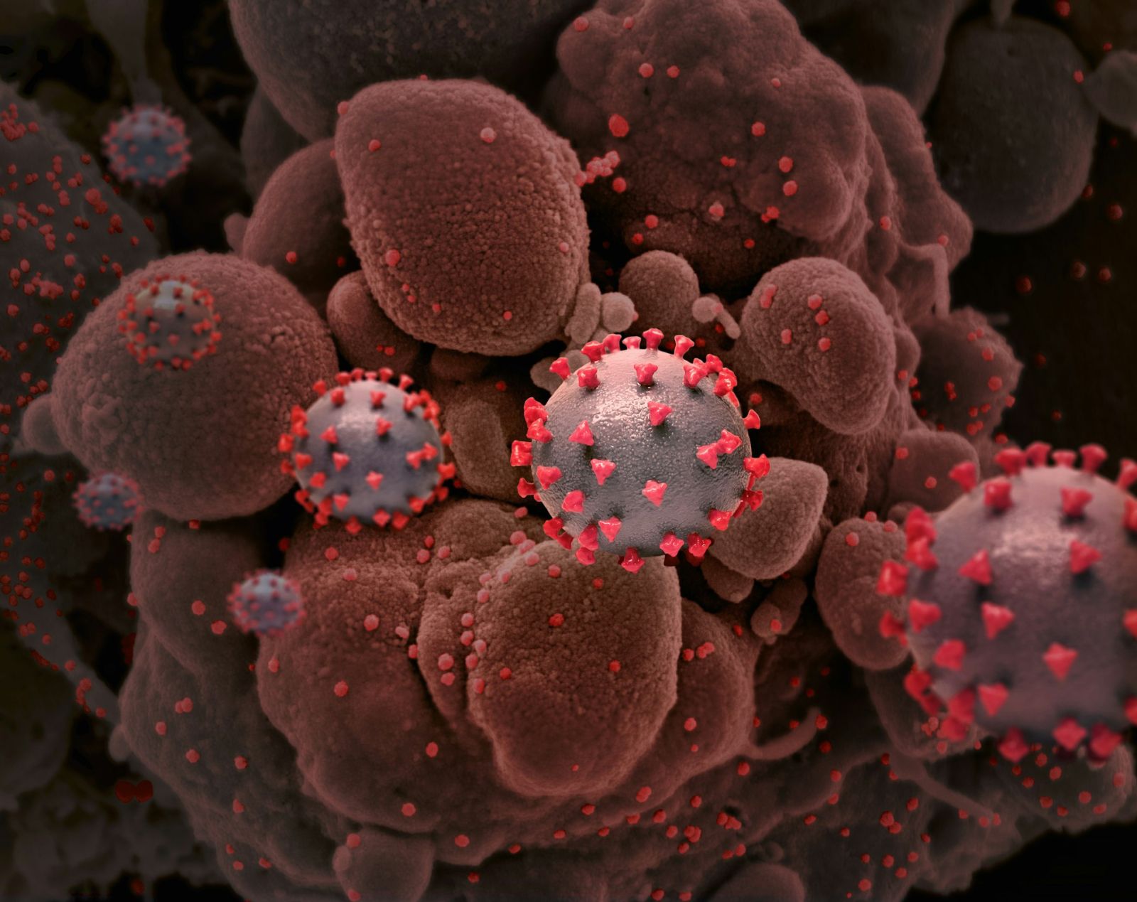 🦠 Some serious viral infections explained by... an abnormality